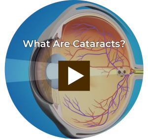 Cataract Surgery – Kumar Eye Institute